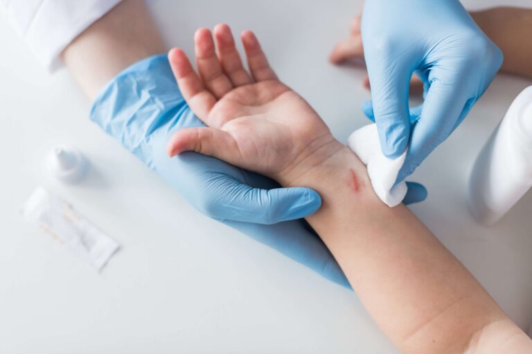 How to Prevent, Diagnose and Treat Wound Infection