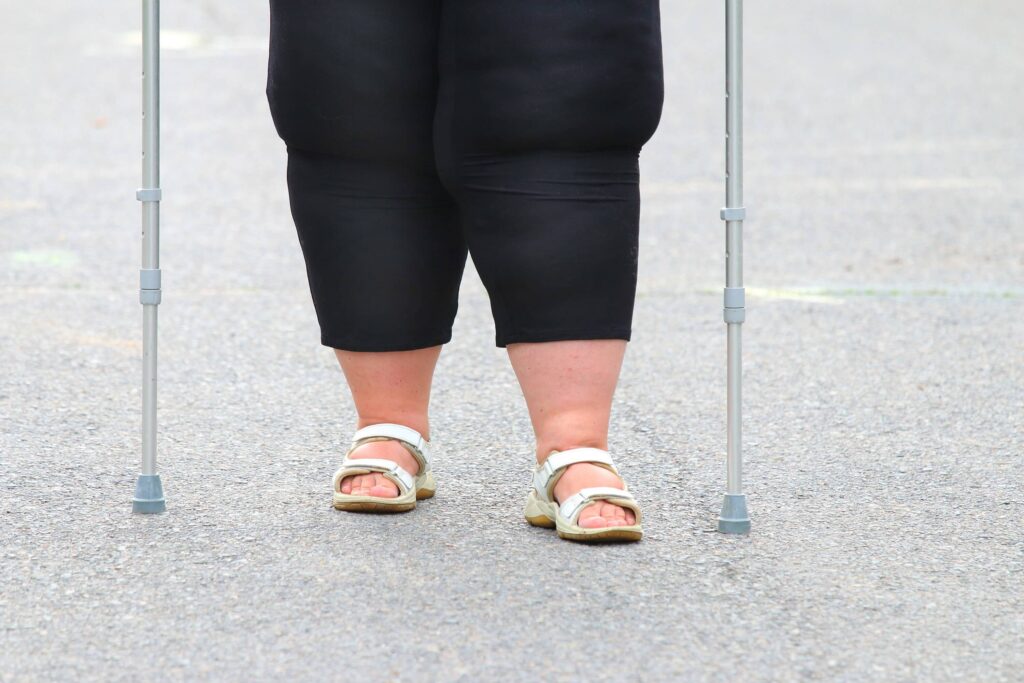 How Does Obesity Affect and Delay Wound Healing