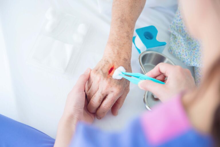 How to Help Open Wounds Heal Faster: A Complete Guide