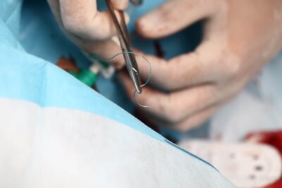 A Guide to Stitches, Staples and Sutures in Wound Care