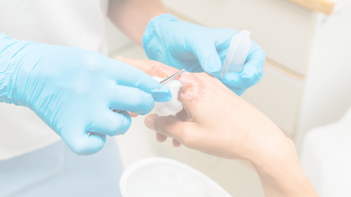 Wound Care & Medicare: Coverage and Treatment Guide