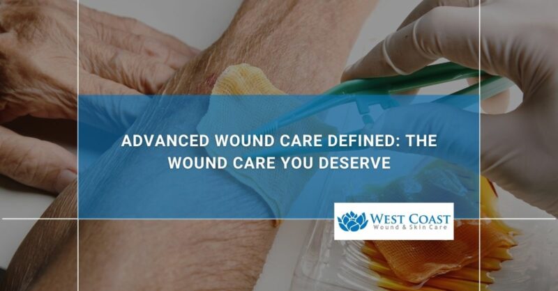 Wound Care Specialists | Wound Care News & Articles
