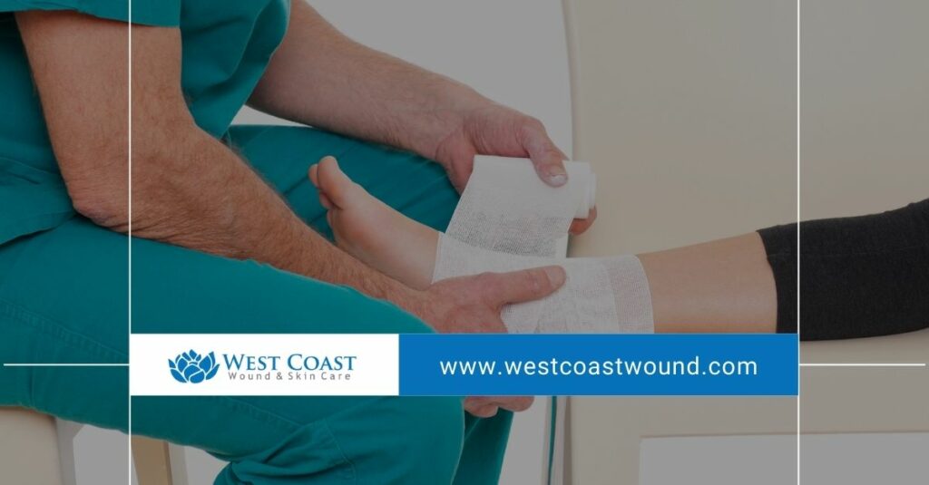 Benefits of Mobile Wound Care | West Coast Wound Center