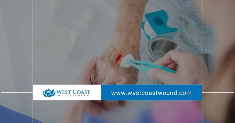 Treatment for Wounds: A Guide to Effective Healing