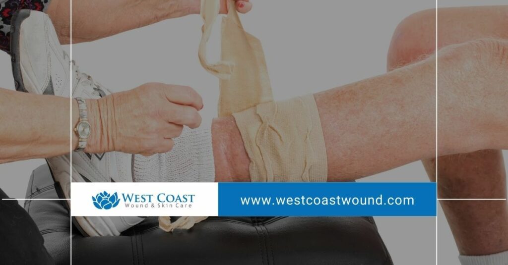 Post Surgical Wound Care at West Coast Wound Care Center