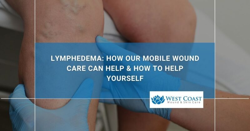 Wound Care Specialists | Wound Care News & Articles