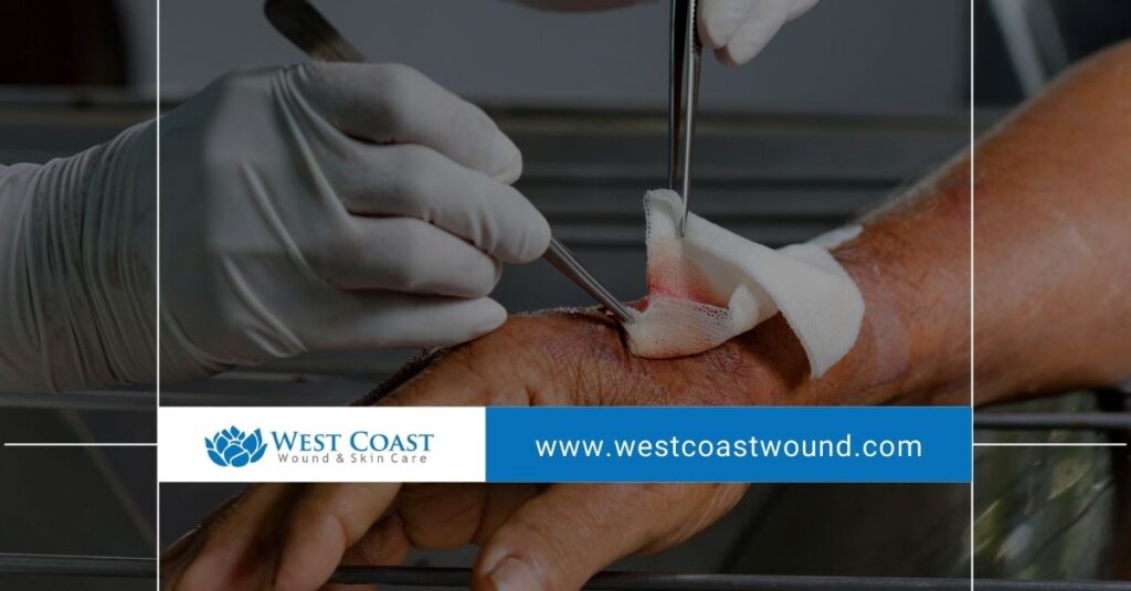 Treating Wounds in Cold Weather: Wound Care Center Tuscon