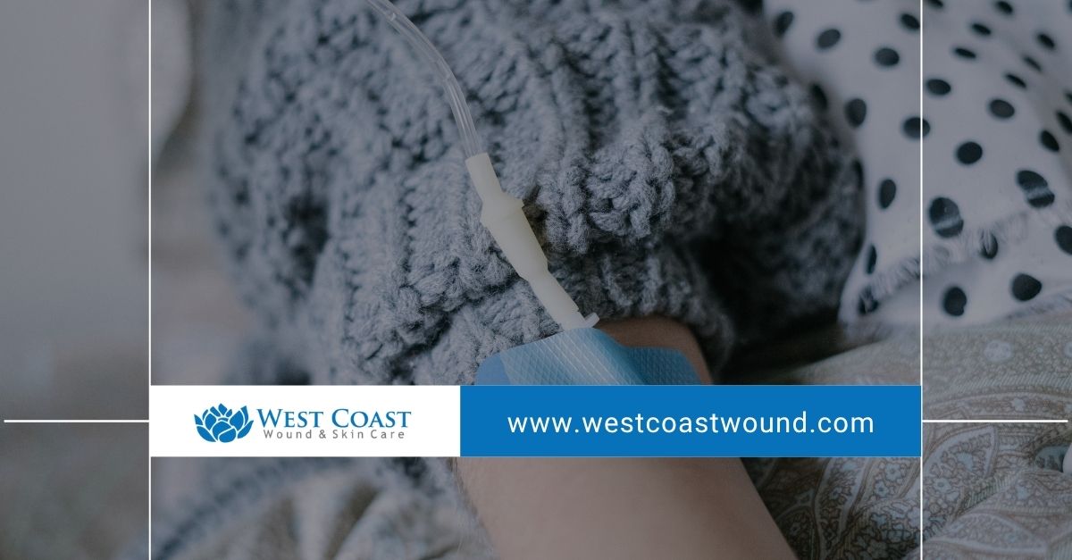Advanced Mobile Wound Care - Infusion Therapy at Home
