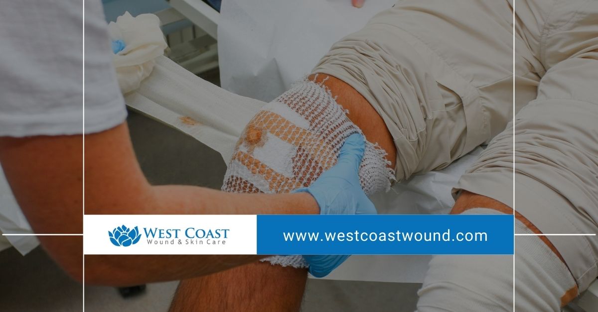 Wound Care Medicare Coverage And Treatment Guide